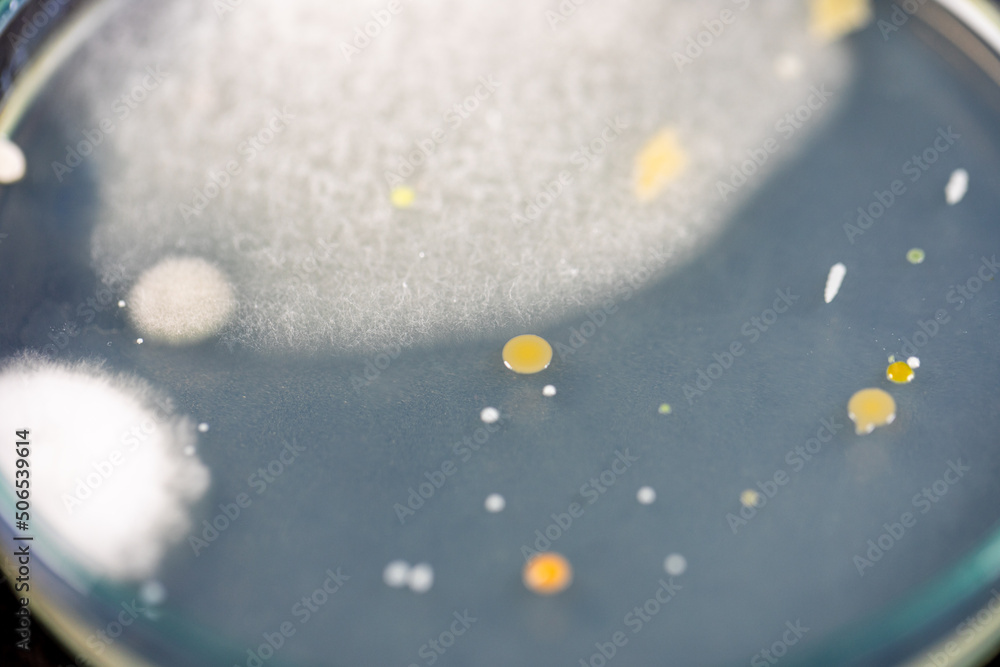 Backgrounds of Characteristics and Different shaped Colony of Bacteria ...