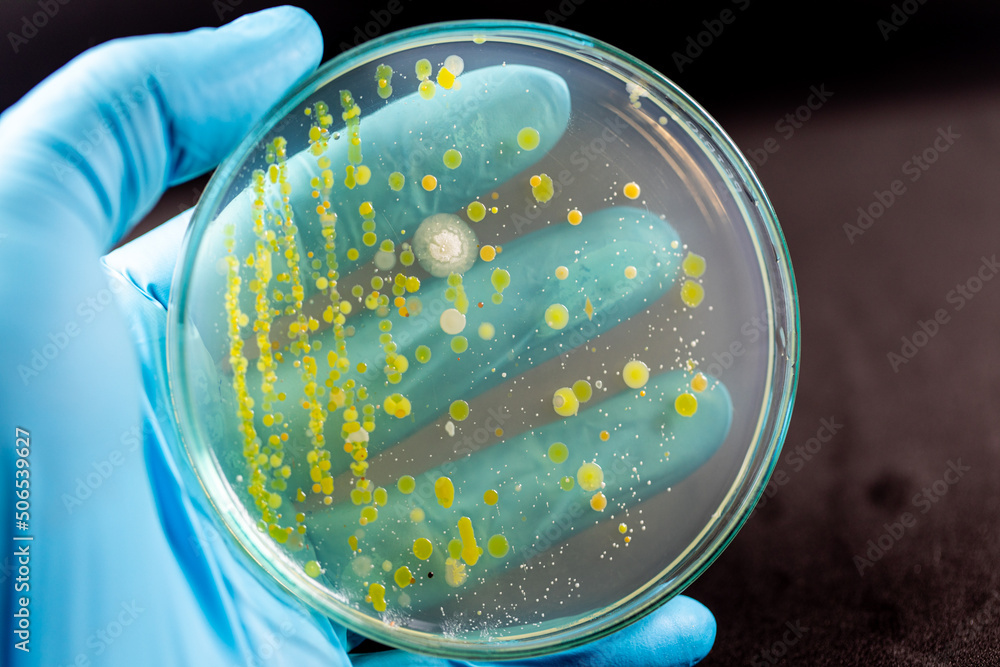 Backgrounds of Characteristics and Different shaped Colony of Bacteria ...