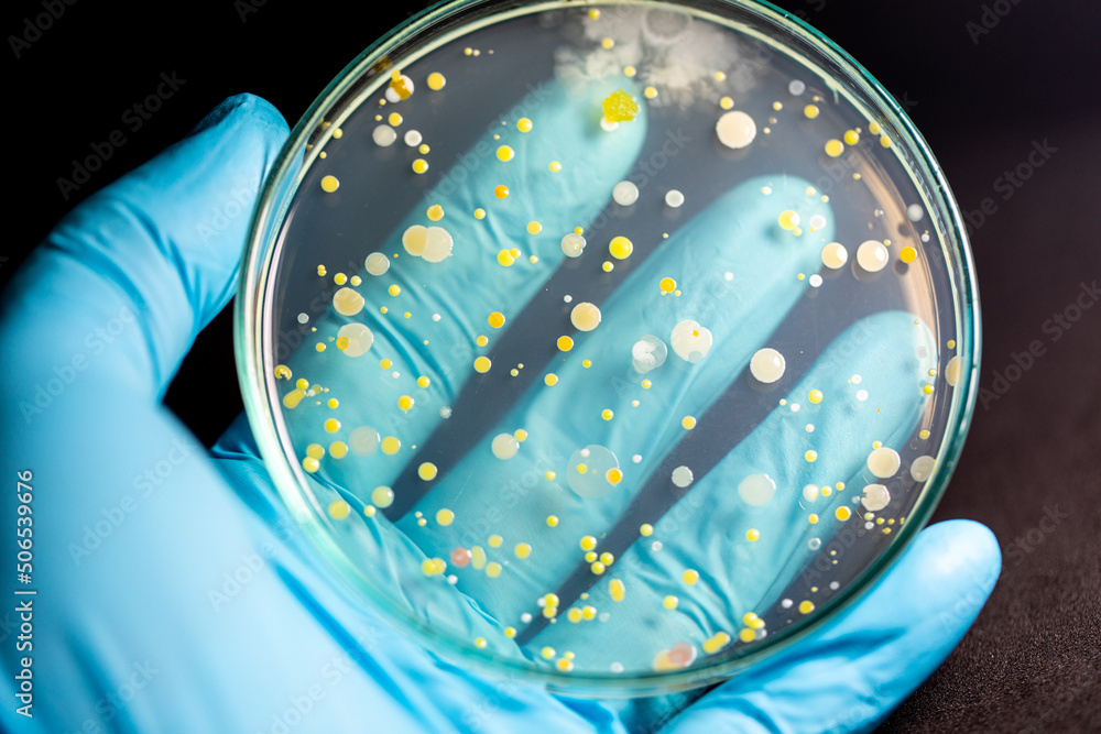 Backgrounds of Characteristics and Different shaped Colony of Bacteria ...