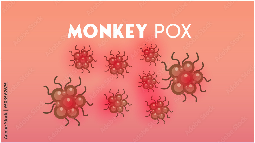 Monkeypox virus illustration, Monkeypox concept, Monkeypox virus ...