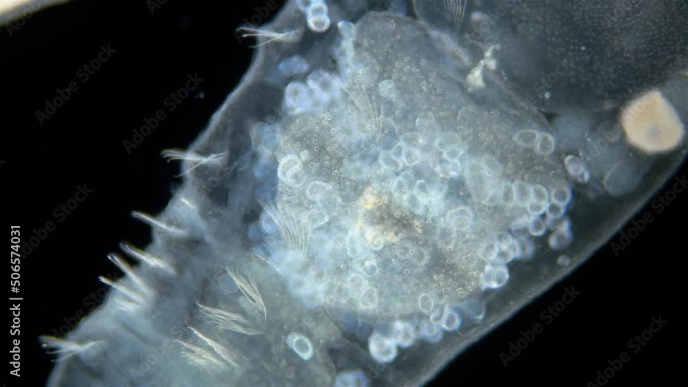 Worm Chaetogaster sp. under the microscope, Class Oligochaeta. Lives in ...