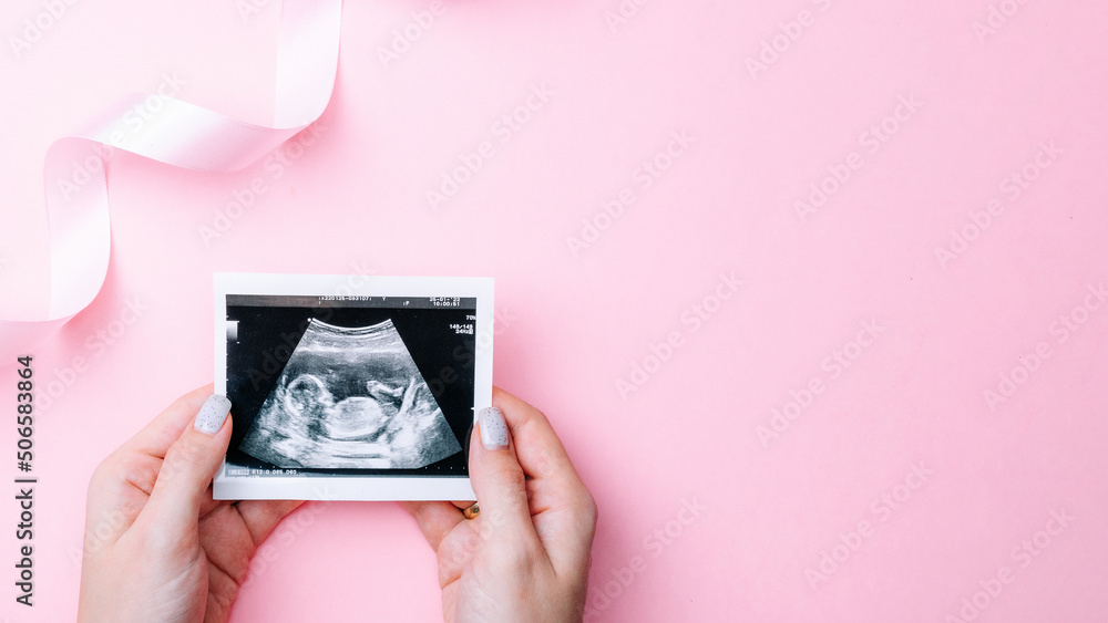 Ultrasound picture pregnant baby photo. Woman hands holding ultrasound ...