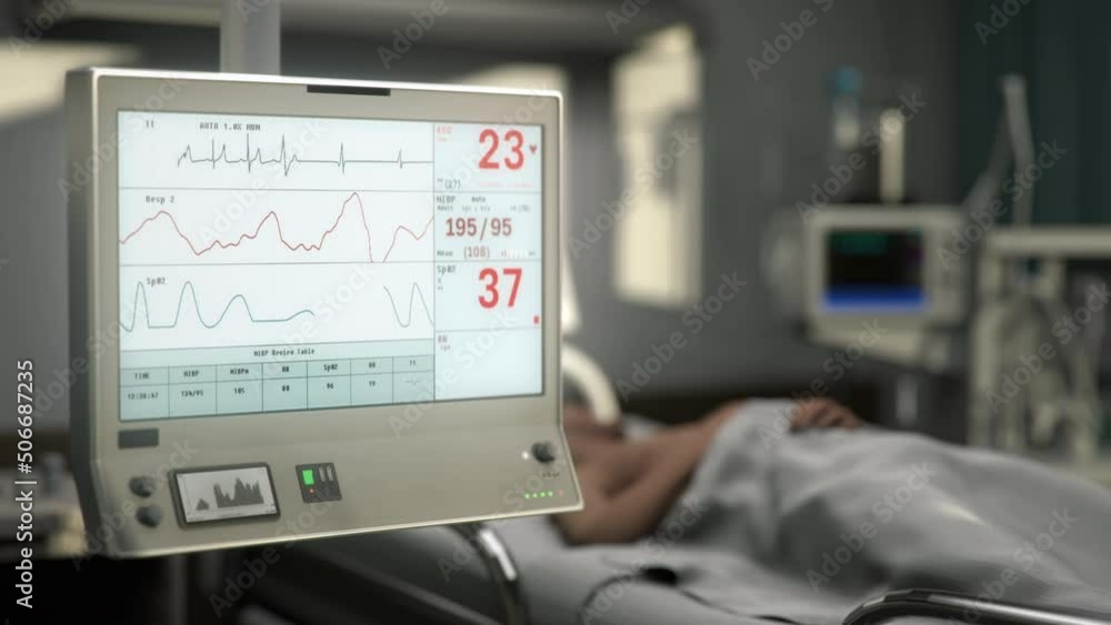 Monitoring Vital Pulse Signs Of Patient By ECG Computer Device. Pulse ...