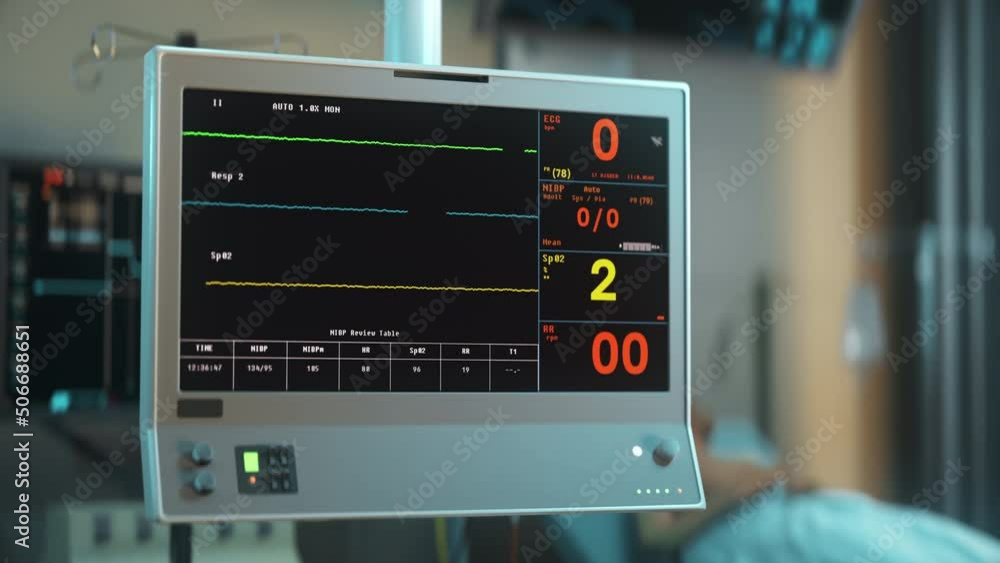 Modern technology shows the heart rate graph of the sick person at a ...