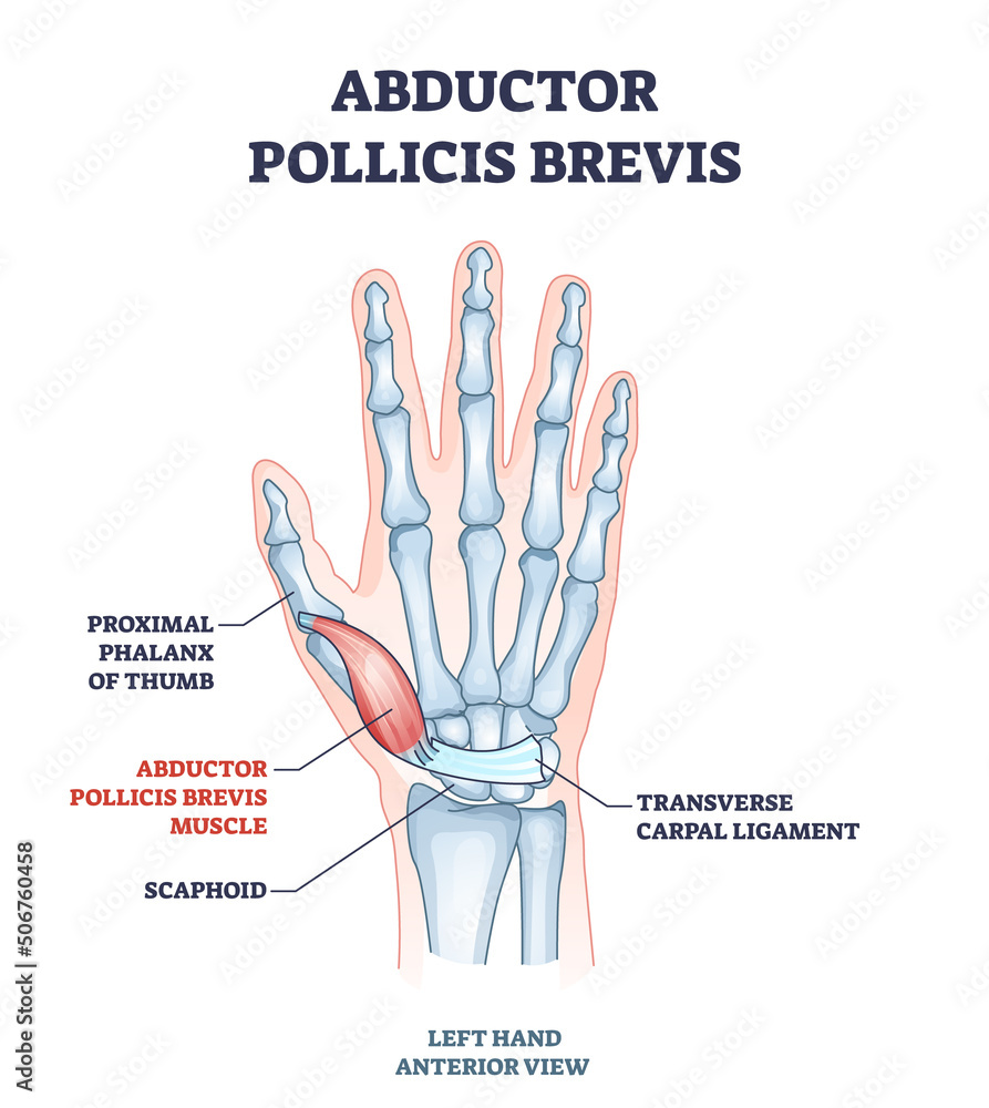 Poster Abductor pollicis brevis muscle with hand and palm bones outline ...