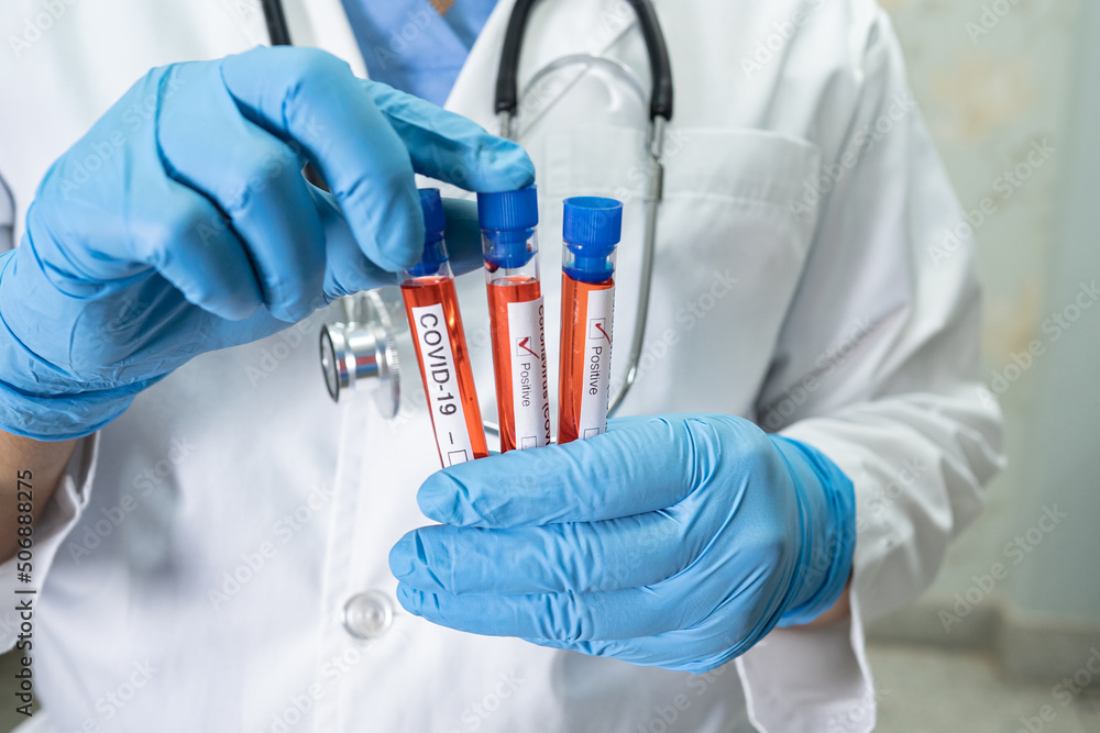 Positive blood infection sample in test tube for covid-19 coronavirus ...