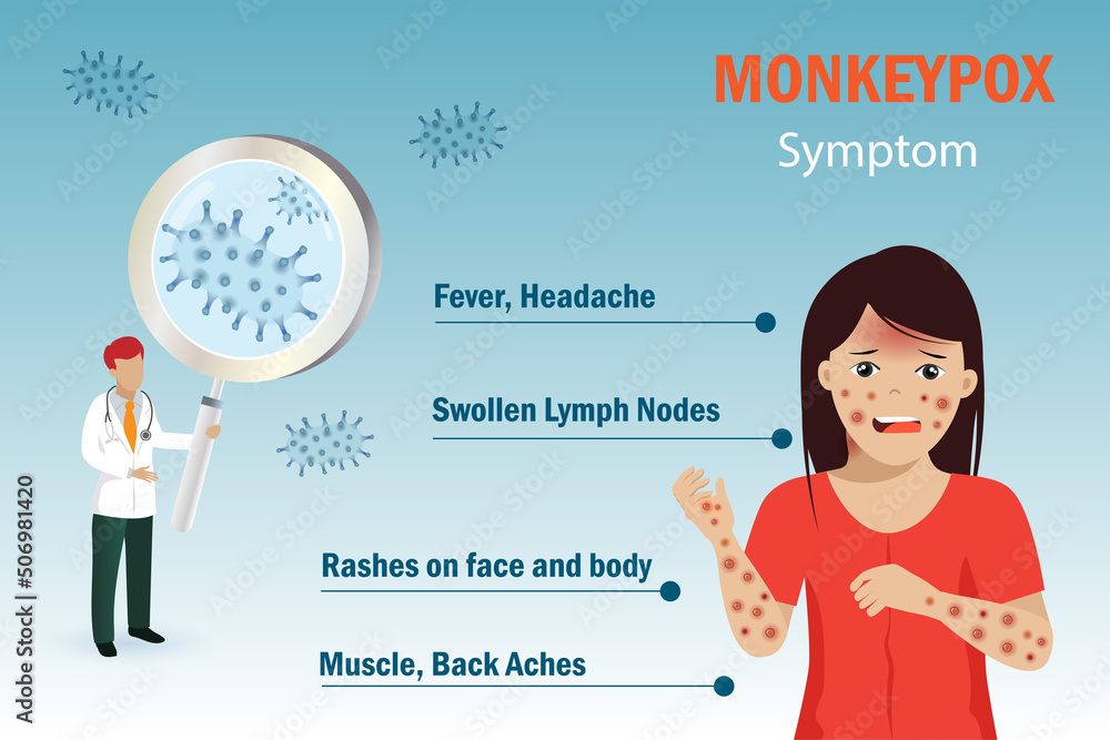 Vettoriale Stock Monkeypox virus symptom infographic on patient. Doctor ...
