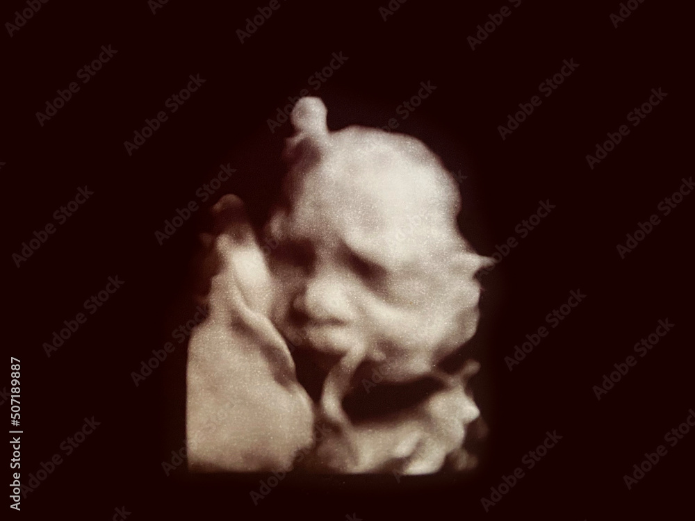Photo & Art Print fetal baby ultrasound picture, EUNJEONG