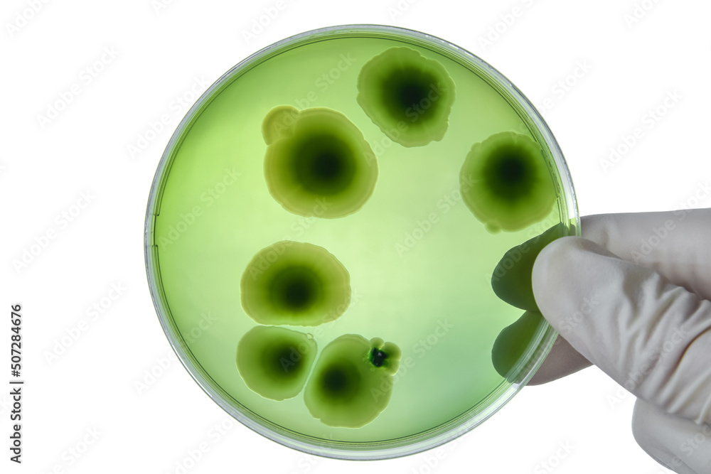 Hand with Petri dish or culture media with bacteria on white background ...