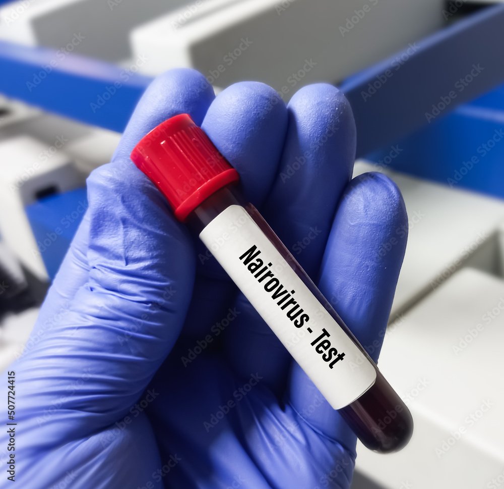 Blood sample for Nairovirus test, Congo hemorrhagic fever, Nairobi ...