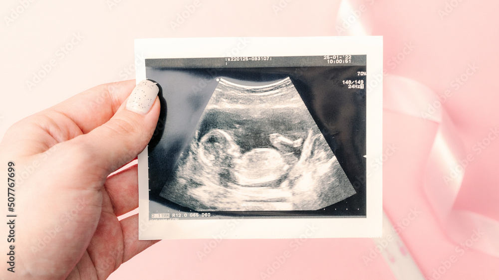 Ultrasound picture pregnant baby photo. Woman hands holding ultrasound ...