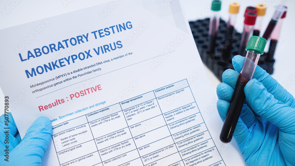 hand holding blood collection tubes and data sheet on monkeypox test ...