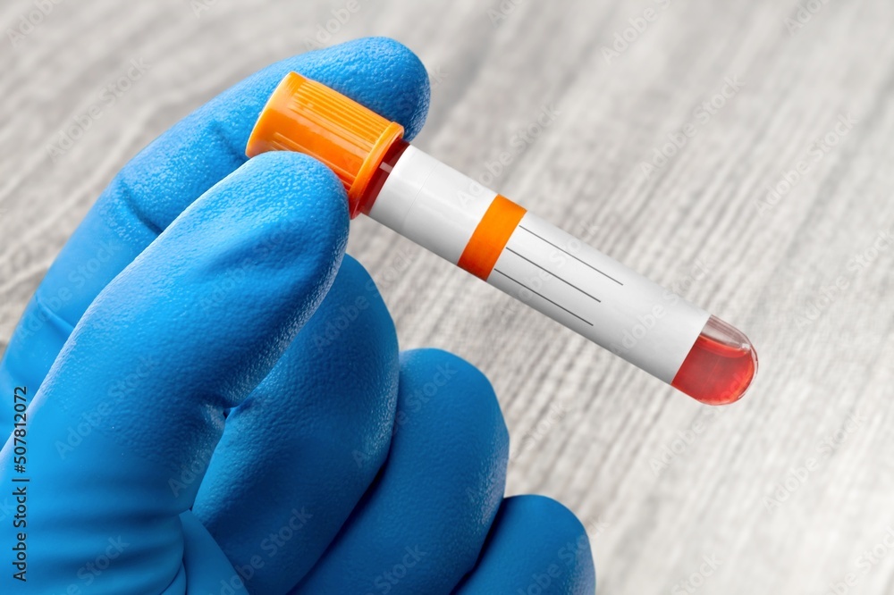 Doctor holding Blood sample tube for analysis test in the laboratory ...