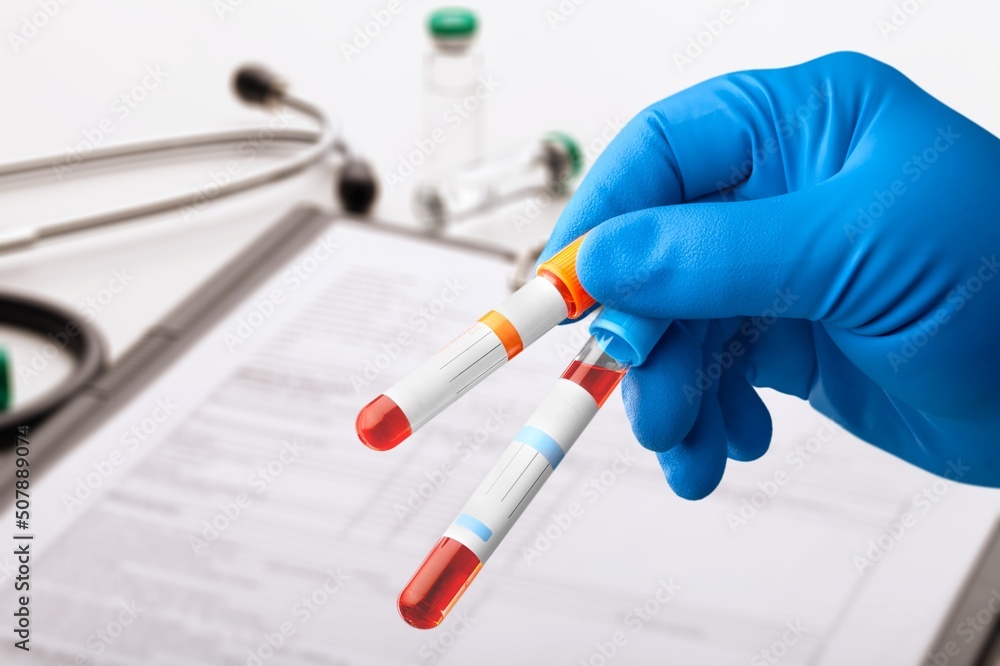Blood sample tube for analysis of test in the laboratory. doctor ...