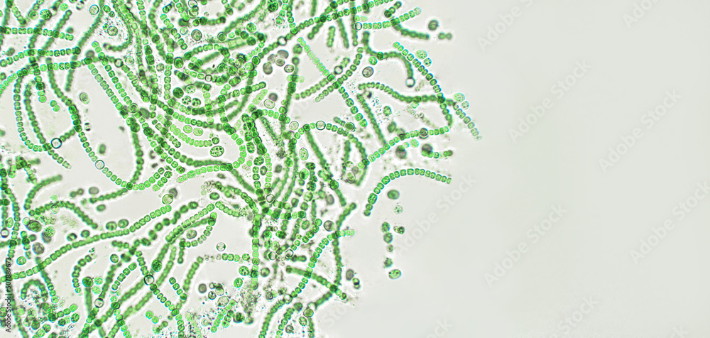Nostoc sp. blue-green algae under microscopic view, cyanobacteria Stock ...