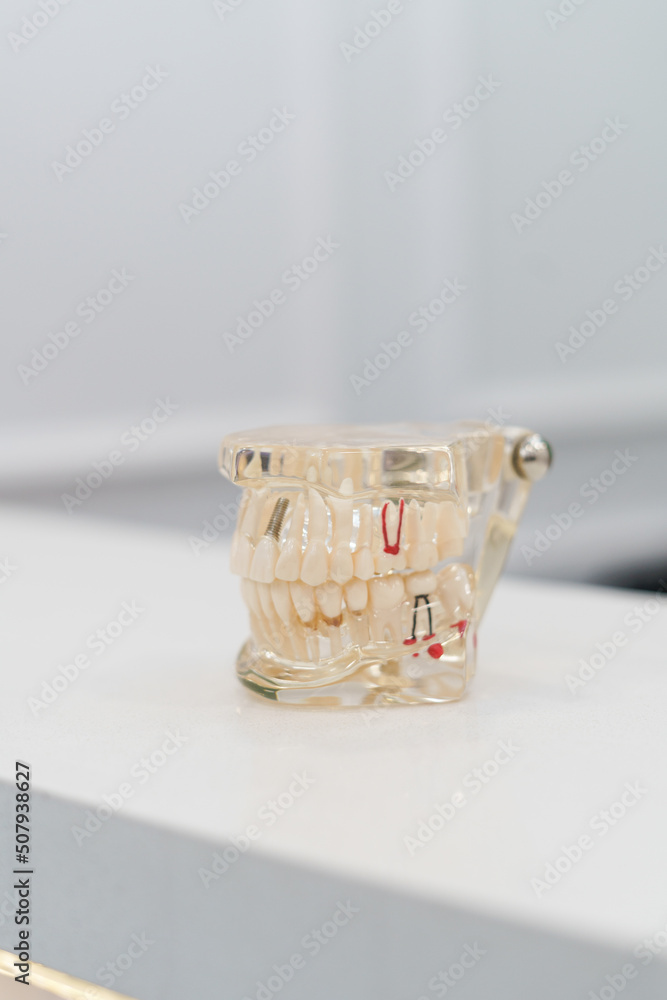 modern glass denture, didactic article for teaching, details of teeth ...