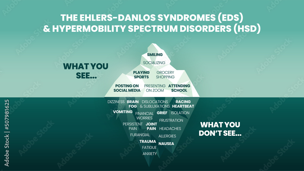 The iceberg model of Ehlers-Danlos Syndromes (EDS) and Hypermobility ...