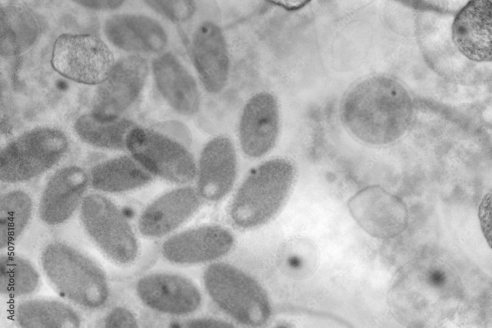 Microscope image of an infectious virus under the microscope, for ...