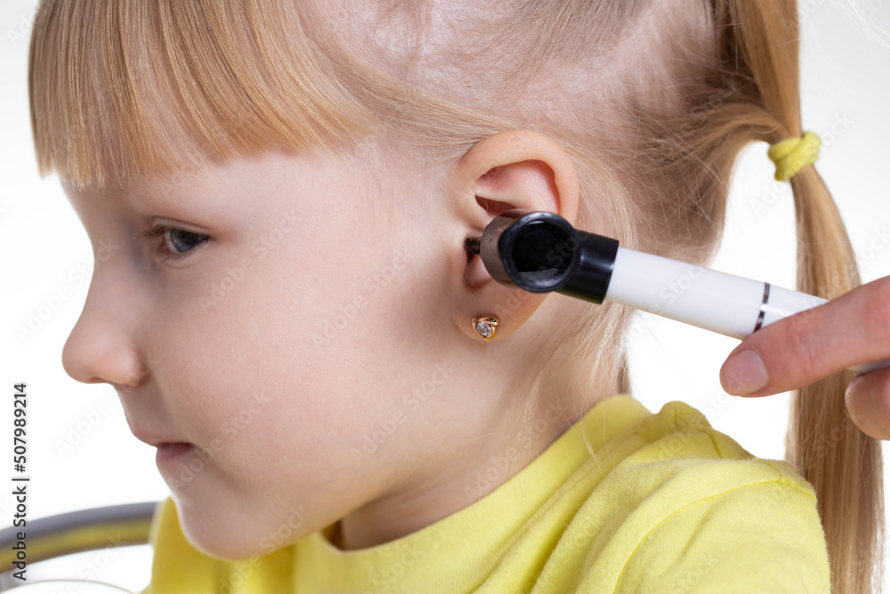 Doctor ENT doctor looks into the ear of a beautiful girl patient at the ...