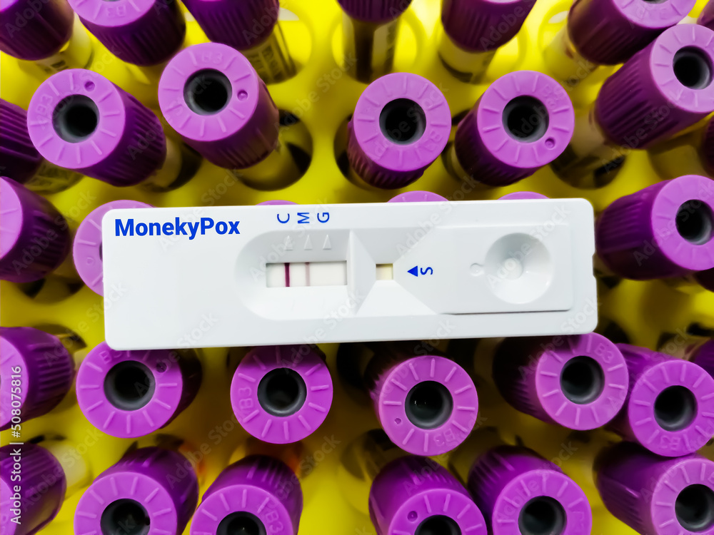 Rapid test cassette for Monkeypox virus antibody (IgG and IgM) test ...