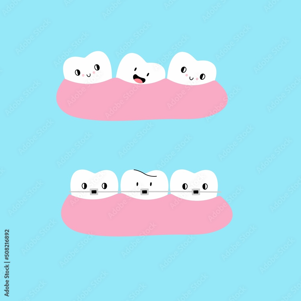 Cartoon Teeth in gum. Straight and crooked teeth. Braces before and ...