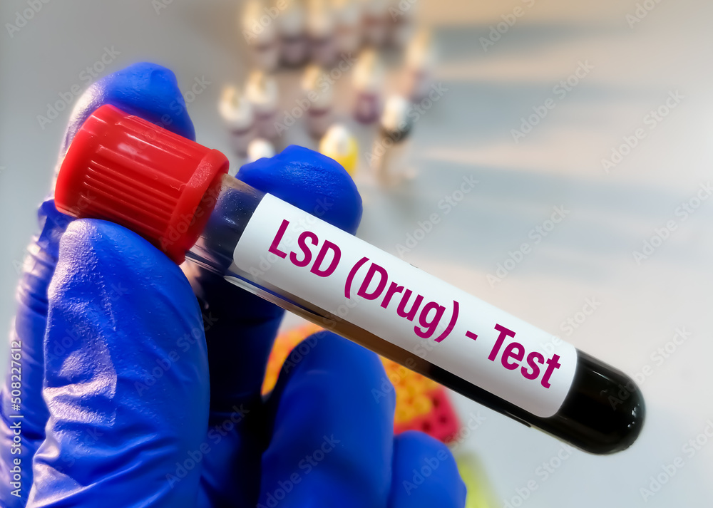 Blood sample for doping drugs test LSD test at medical laboratory for ...