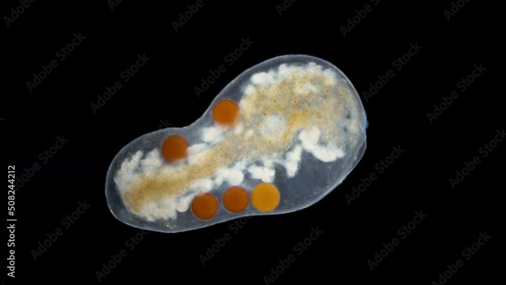 A worm from the family Typhloplanidae under a microscope, Order ...