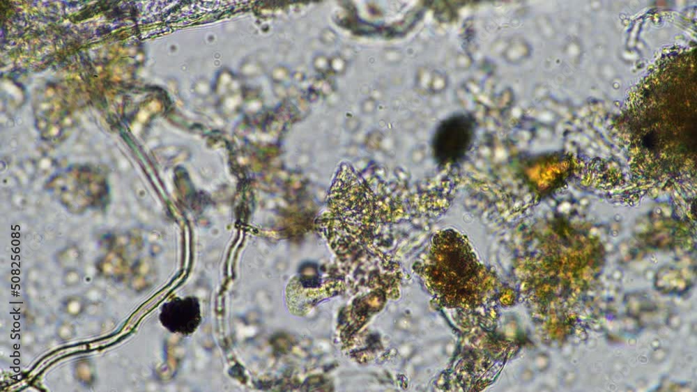 Fungal and fungi hyphae under the microscope in the soil and compost ...