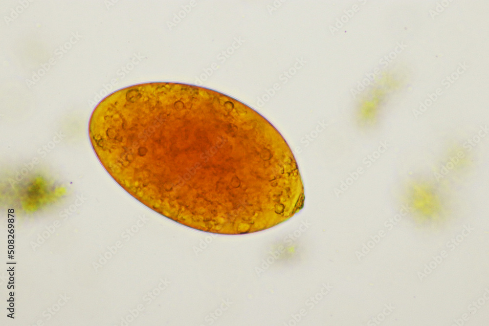 Egg of intestinal fluke in human stool, analyze by microscope, original ...