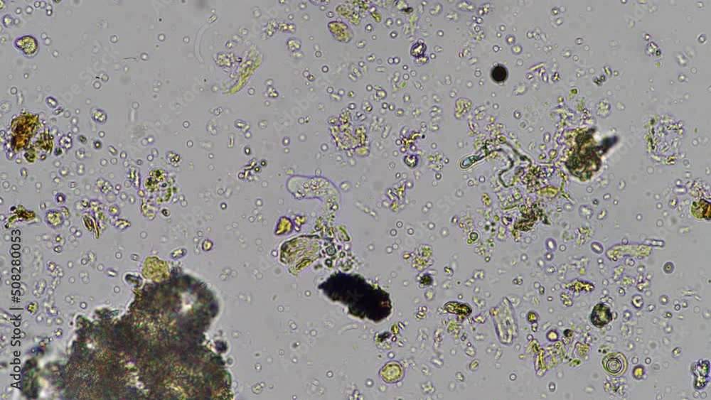 naked amoeba in compost and soil, under the microscope vídeo do Stock ...