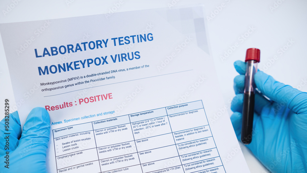 hand holding blood collection tubes and data sheet on monkeypox test ...