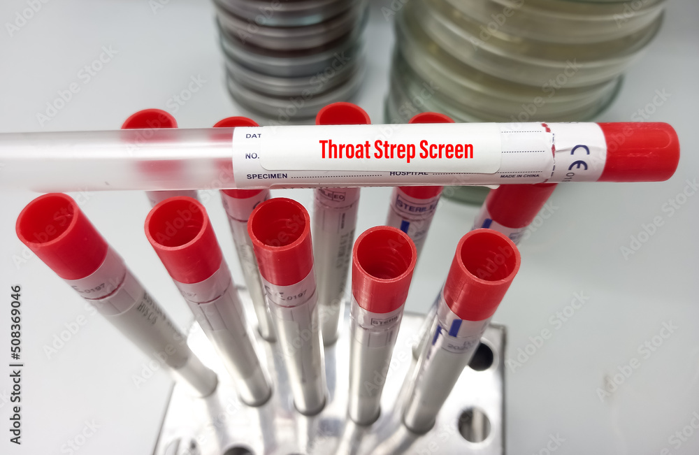 Throat swab sample for throat strep screen test. to diagnose an ...