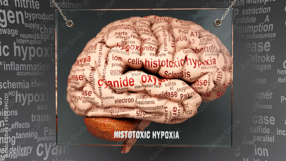 Histotoxic hypoxia in human brain - dozens of terms describing its ...