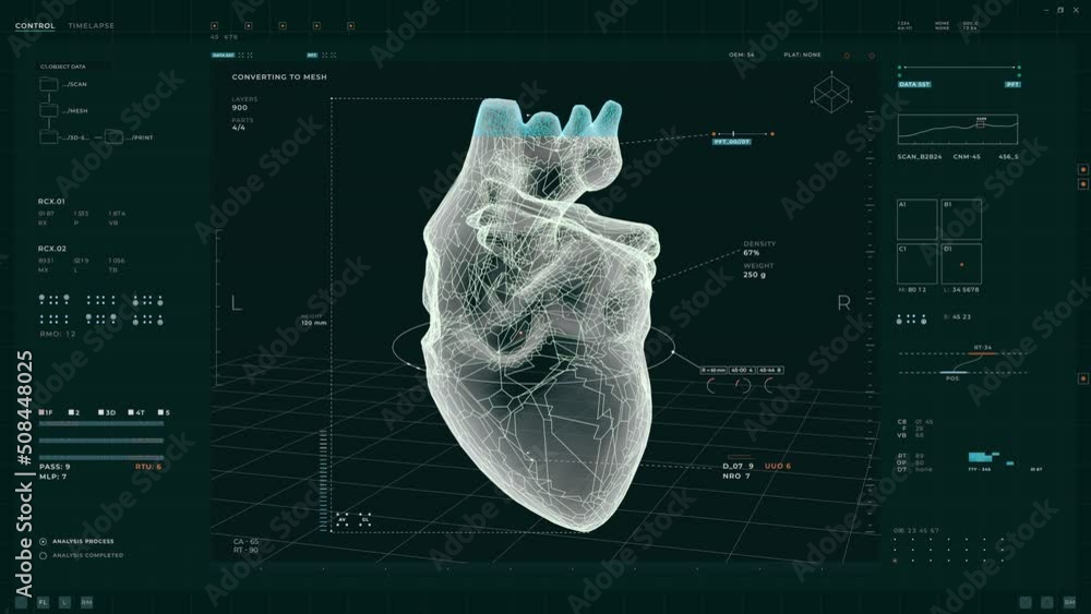 Using 3D printing software at the medical laboratory. Medical ...