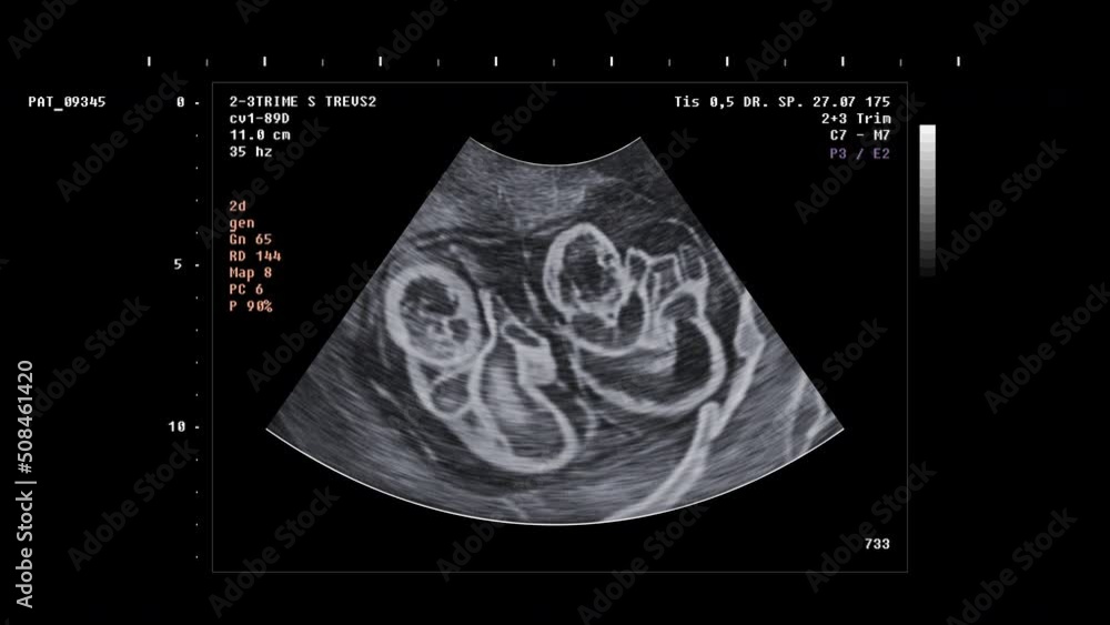 Vidéo Stock Diagnostic scanner deals with a baby examination procedure ...
