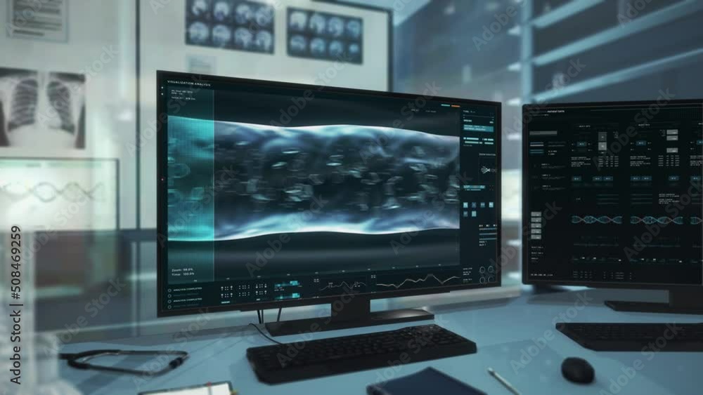 Medical Microscopic scanner interface is analyzing the patients hand ...