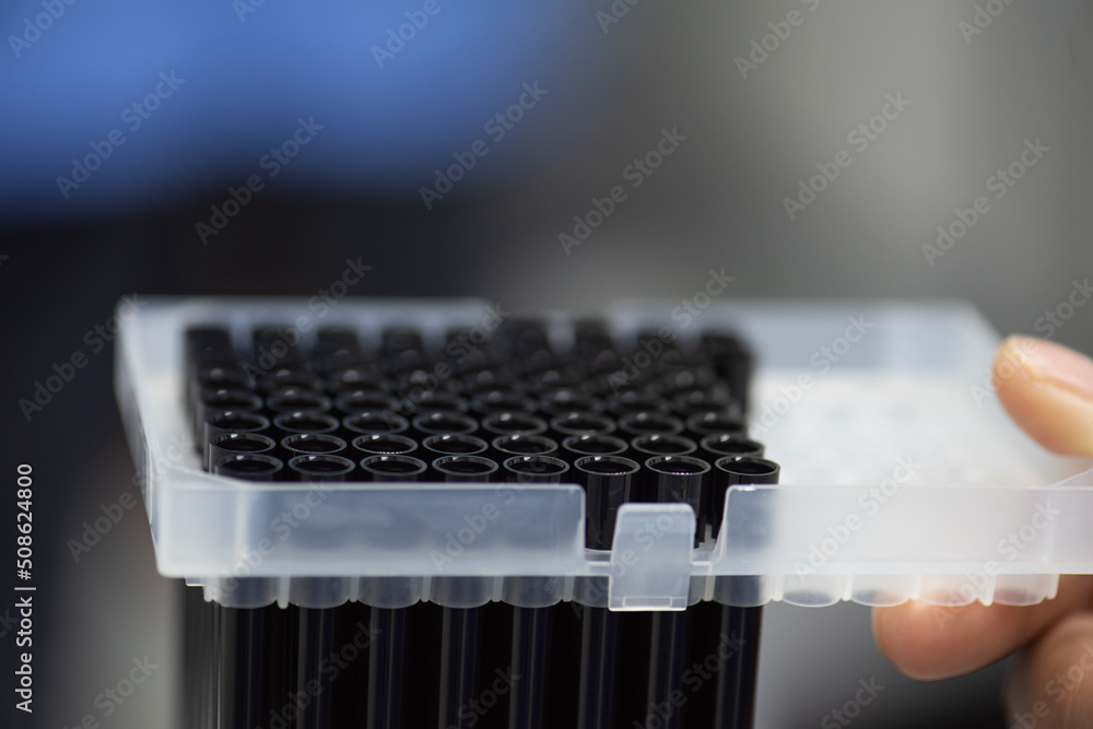Foto de Medical scientists are examining HPV DNA in specimens from ...