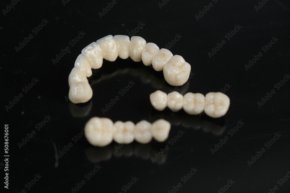 Dental ceramic bridge on isolated wite background. Metal free ceramic ...