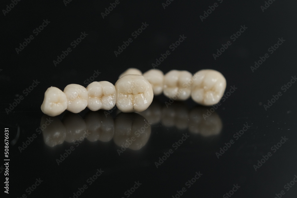 Dental ceramic bridge on isolated wite background. Metal free ceramic ...