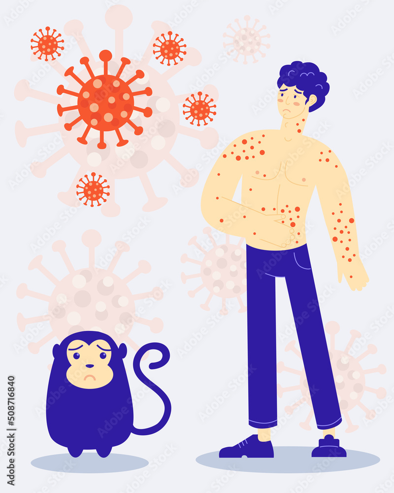 Vector illustration of showing monkey pox outbreak, man showing pain ...