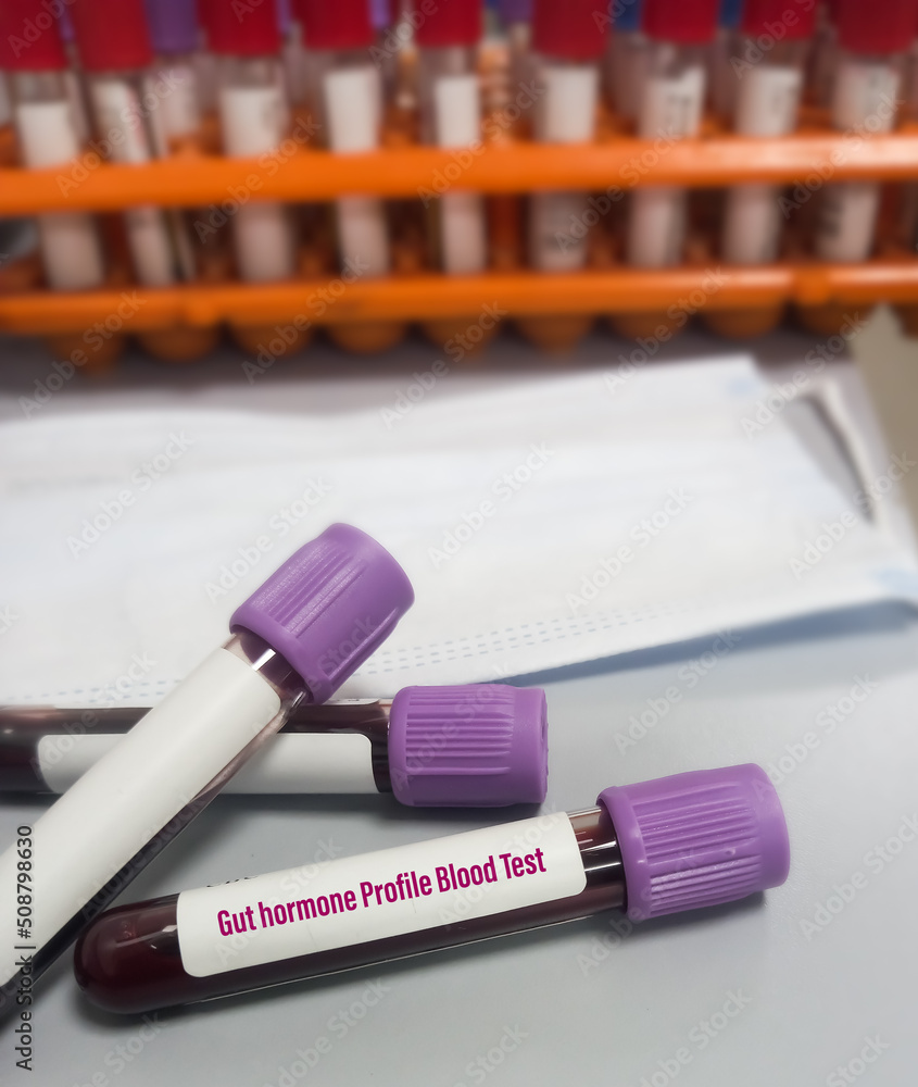 Blood sample for Gut hormone profile blood test, suggestive of ...