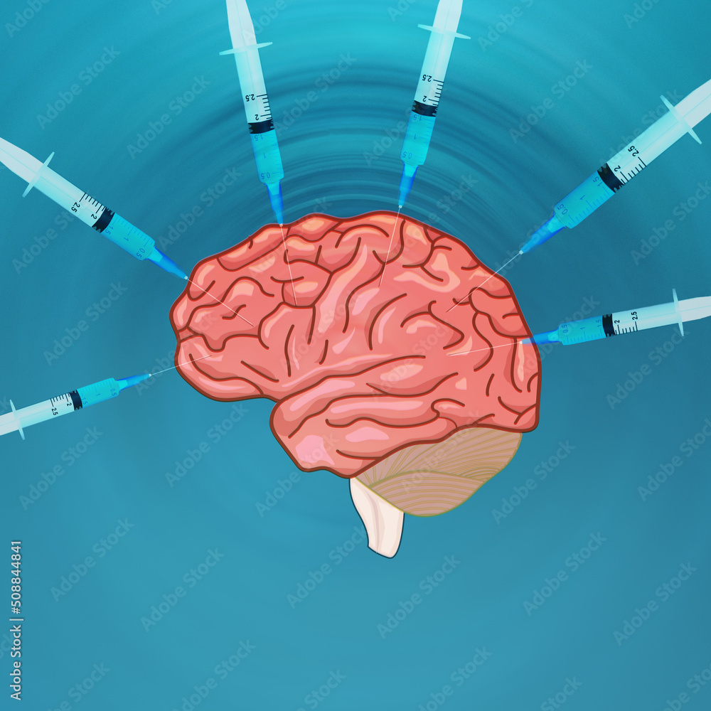 Brain injection, brainwashing, flashing, introduction of new ...