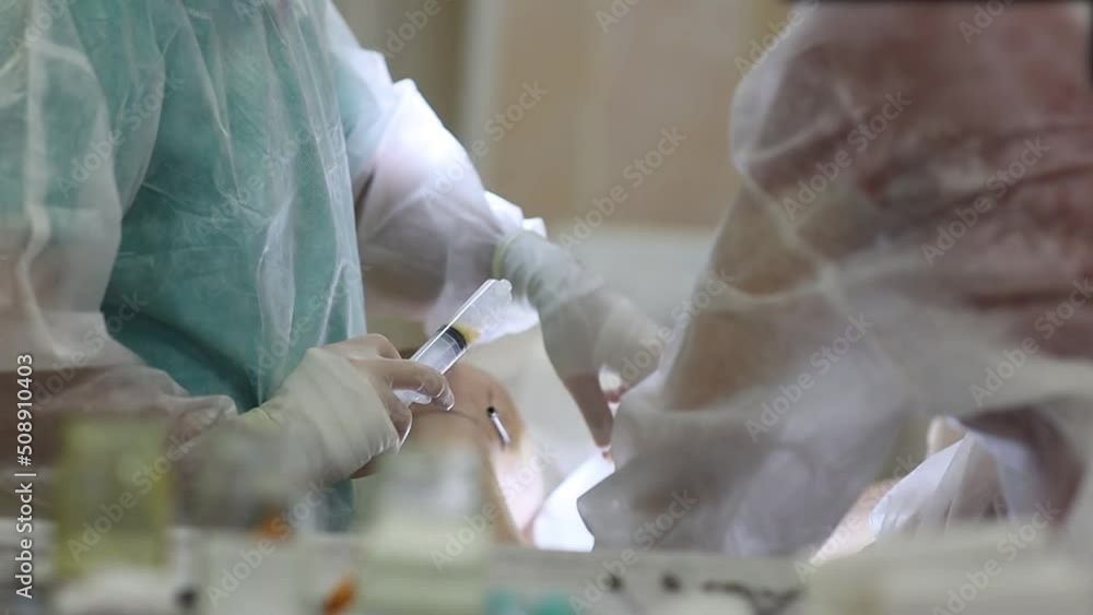 surgical operation lipofilling, liposuction syringes with adipose ...