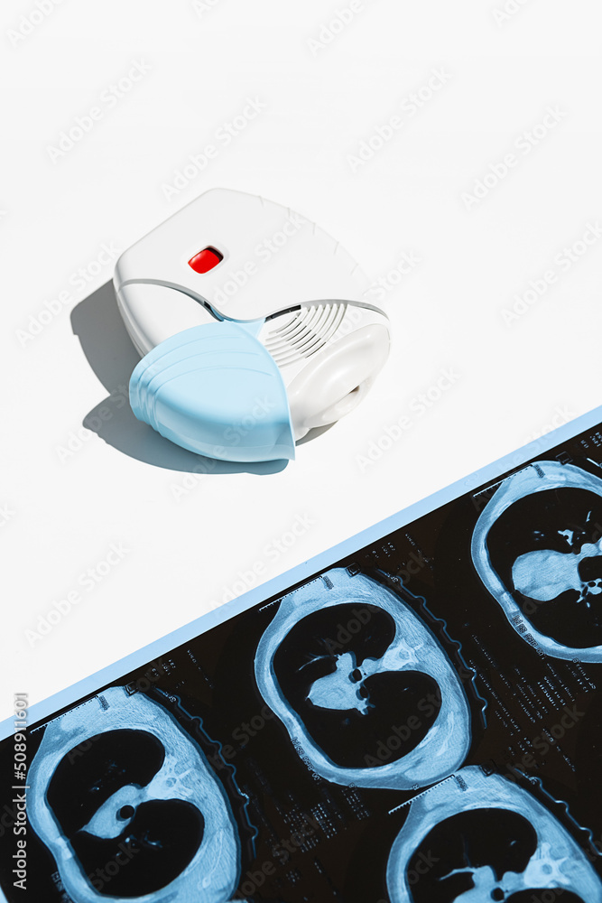 Asthma inhaler and CT scan of the lungs on white table. Aerosol for ...