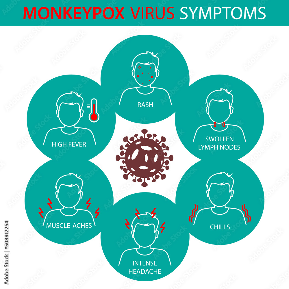 Symptoms of the monkey pox virus. Monkey pox is spreading. This causes ...