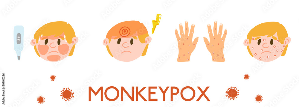 Monkeypox virus symptoms as fever, headache, rash in flat cartoon style ...