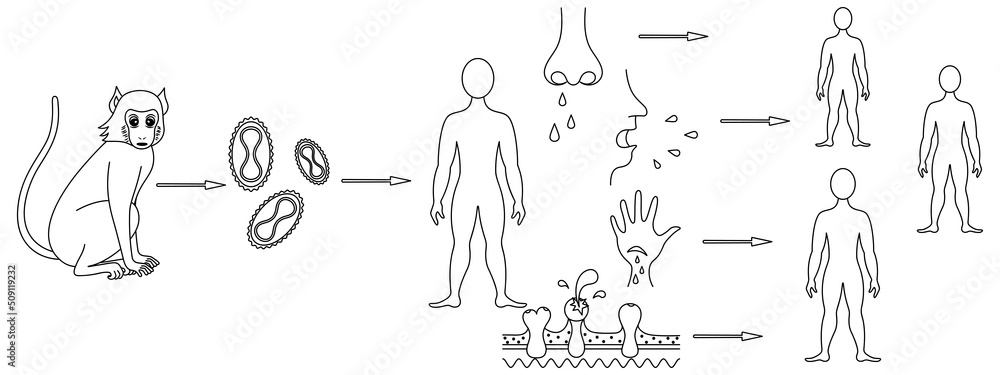Stockvector Monkeypox. Scheme of infection and methods of transmission ...
