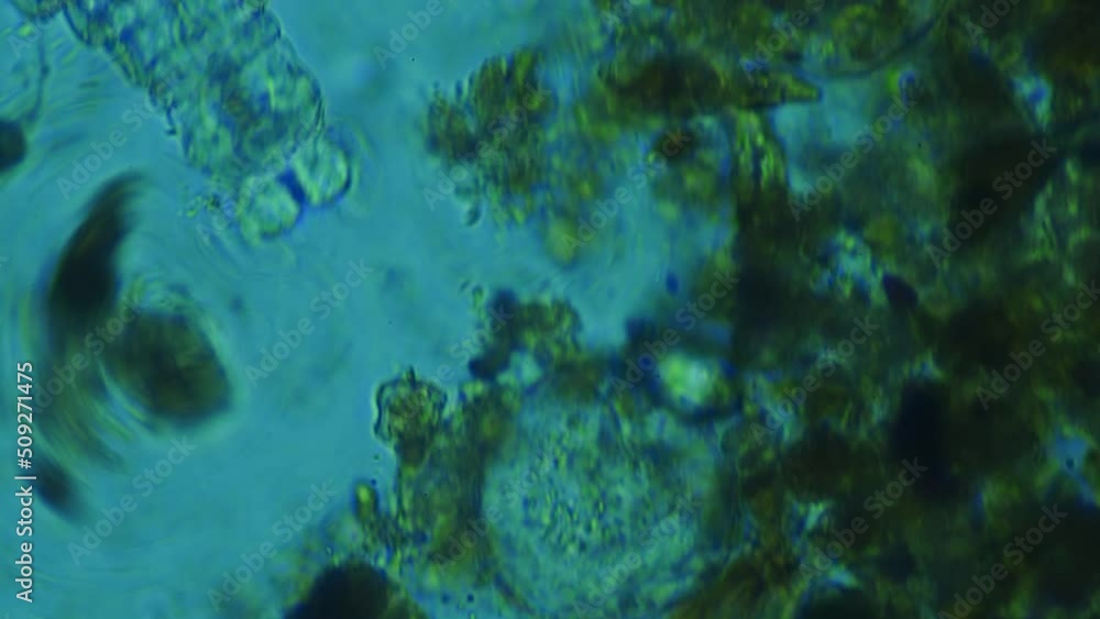 Rotifer, testate amoebae and Fungal and fungi hyphae under the ...