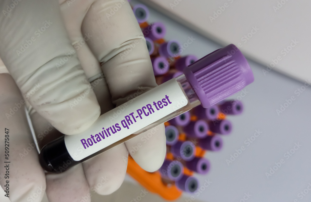 Laboratory technologist hold blood sample for Rota virus qRT-PCR test ...