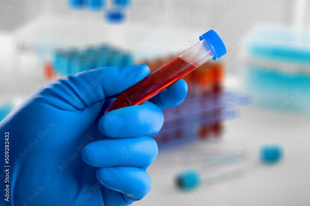 Blood sample of patient for test in laboratory. Doctor with Blood tube ...